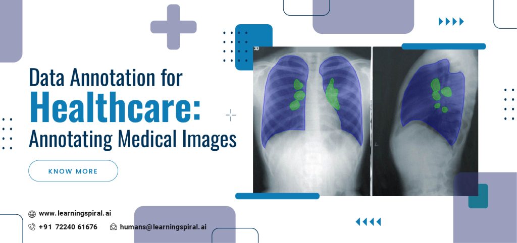 Data Annotation for Healthcare | Data Annotation Company
