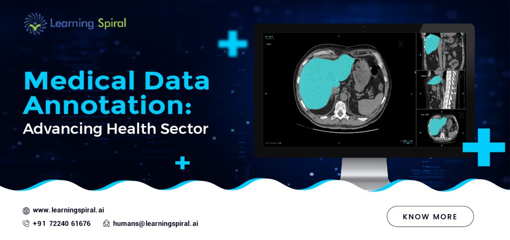 Medical Data Annotation: Advancing Health Sector